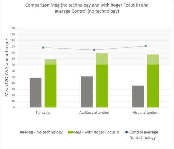 Could Roger Focus II be of benefit for the children you see with a UHL ...
