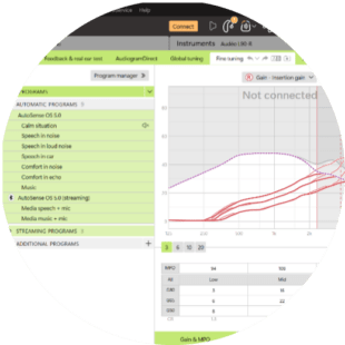 Figure 1: Screenshot of Phonak Target 10.0 with a new color scheme.