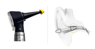 Figure 2: EVOB and TFG support deeper impressions for discreet ...